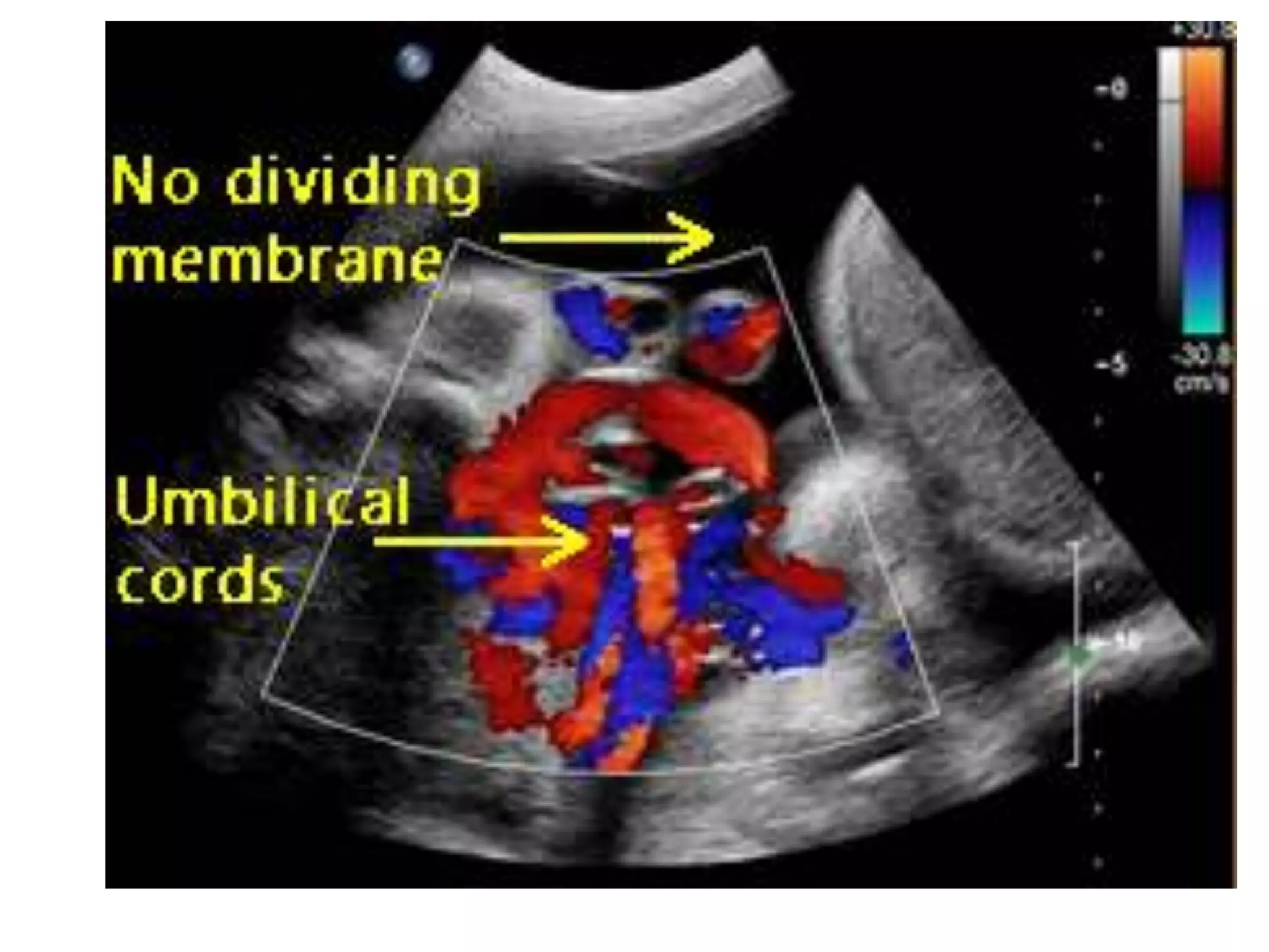 Clinical application of doppler in obstetrics new | PPTX