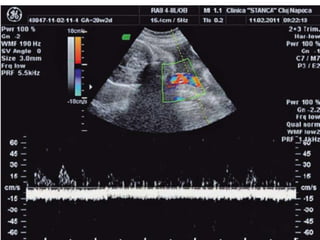 Clinical application of doppler in obstetrics new | PPTX