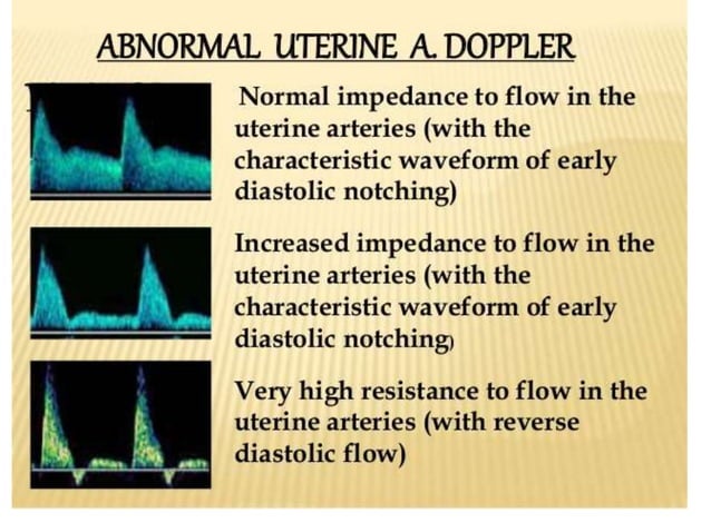 Clinical application of doppler in obstetrics new | PPTX | Pregnancy ...