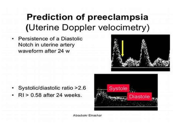 Clinical application of doppler in obstetrics new | PPTX | Pregnancy ...