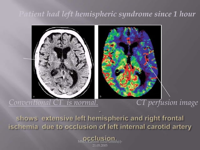 Clinical application of helical ct scan in husm edu publish-mma kareem ...