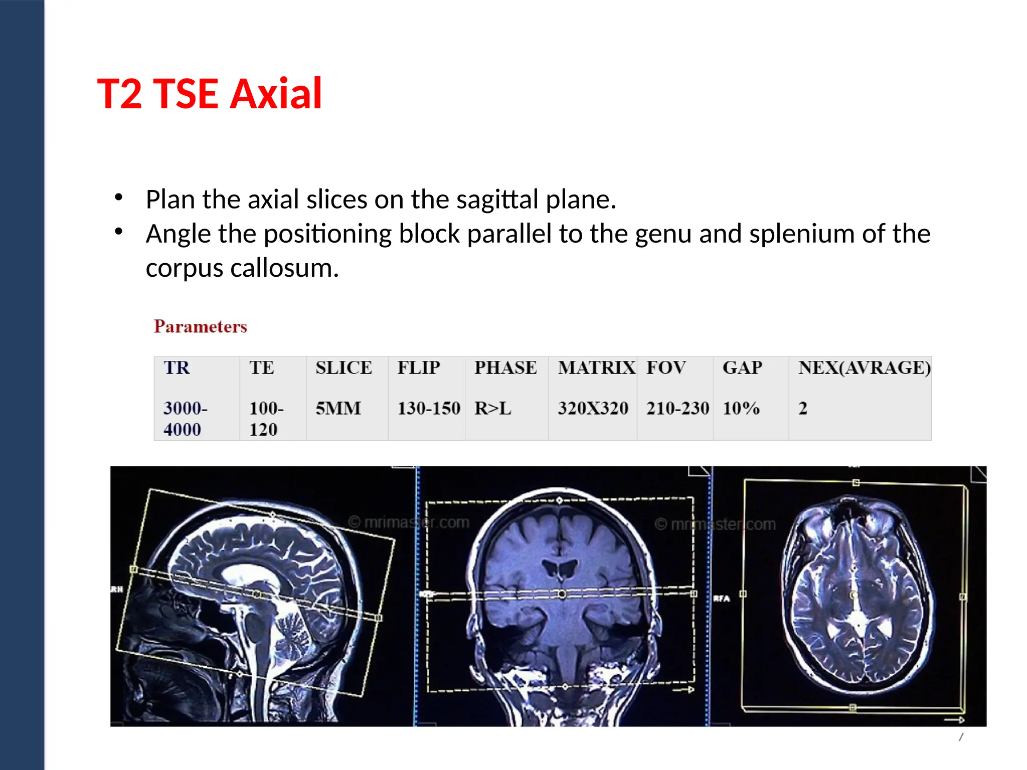 Clinical application of mri by joginder.pptx