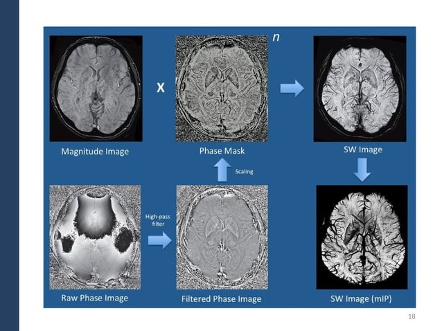 Clinical application of mri by joginder.pptx