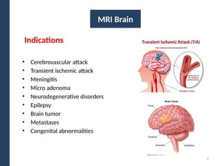 Clinical application of mri by joginder.pptx