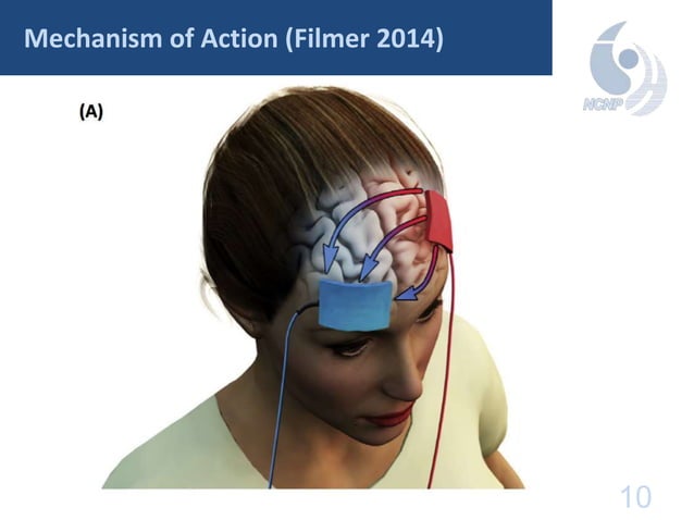Clinical application of tDCS | PPTX