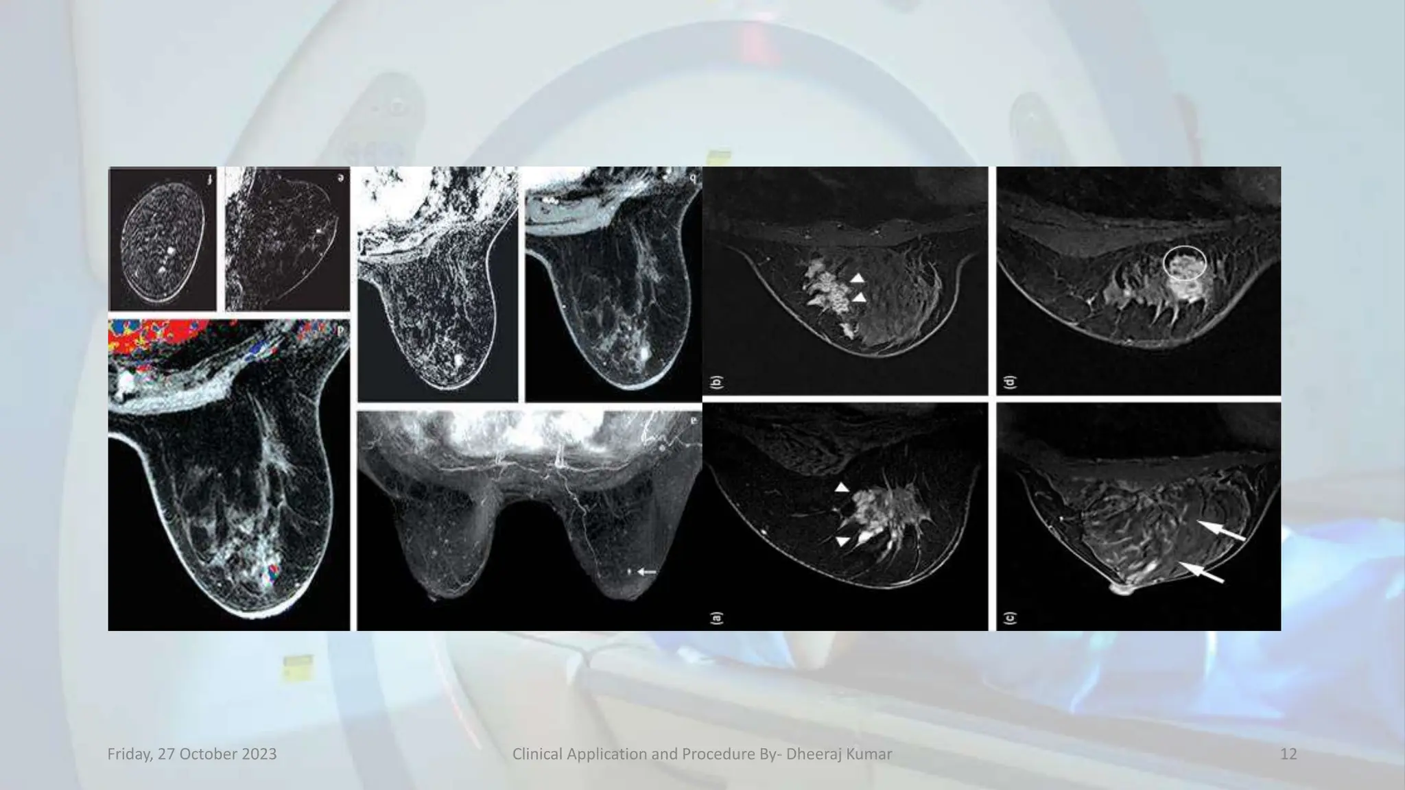 Clinical Applications and Procedure of MRI.pptx