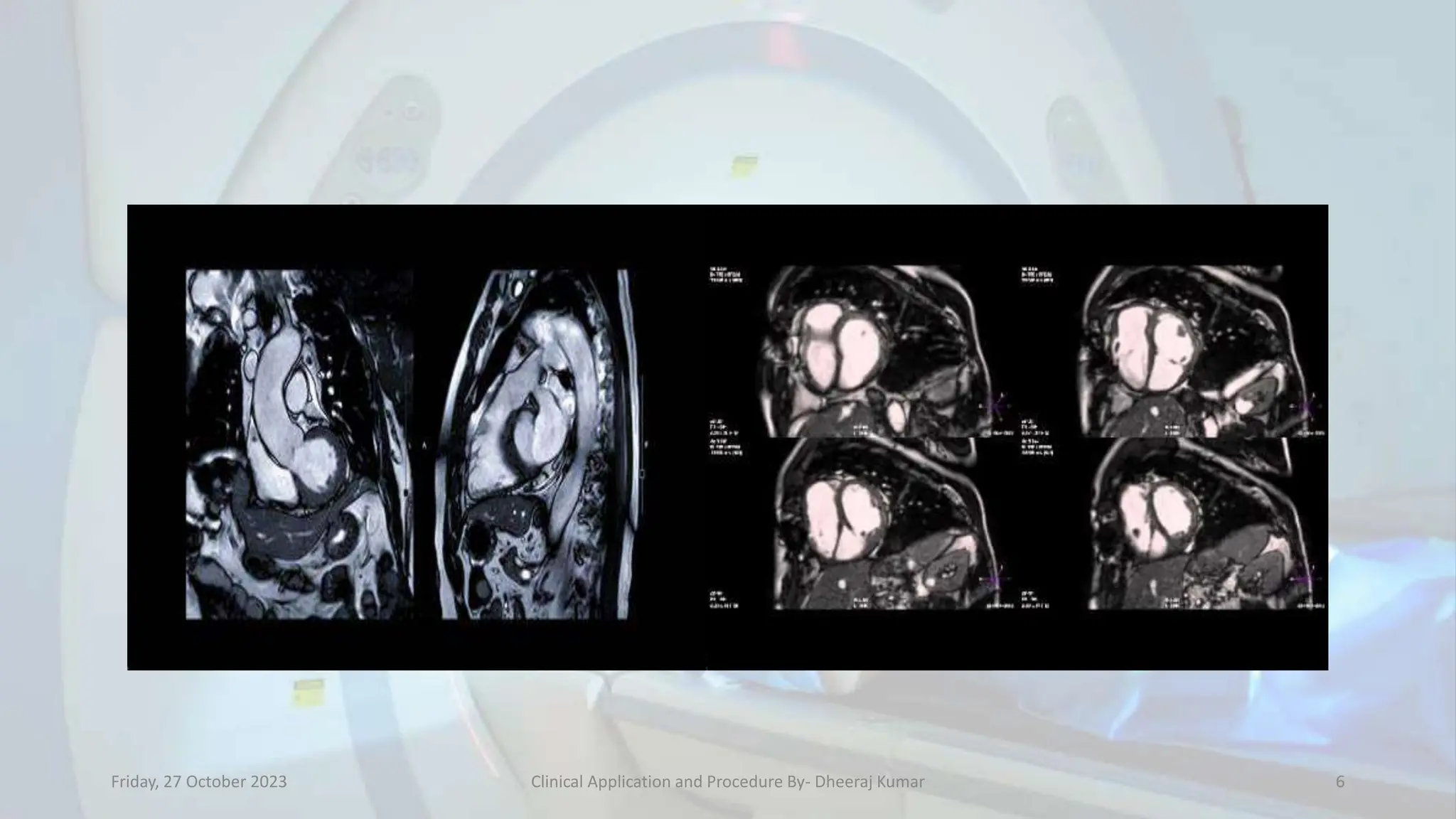 Clinical Applications and Procedure of MRI.pptx