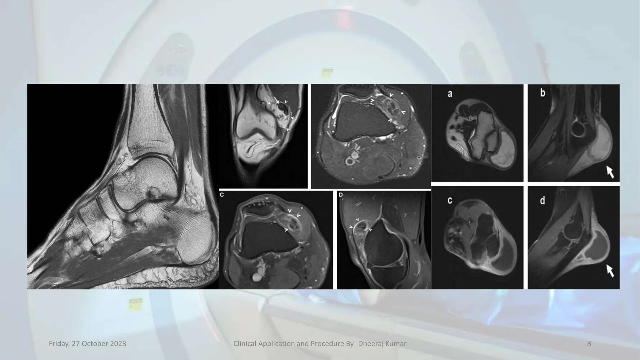 Clinical Applications and Procedure of MRI.pptx