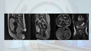 Clinical Applications and Procedure of MRI.pptx