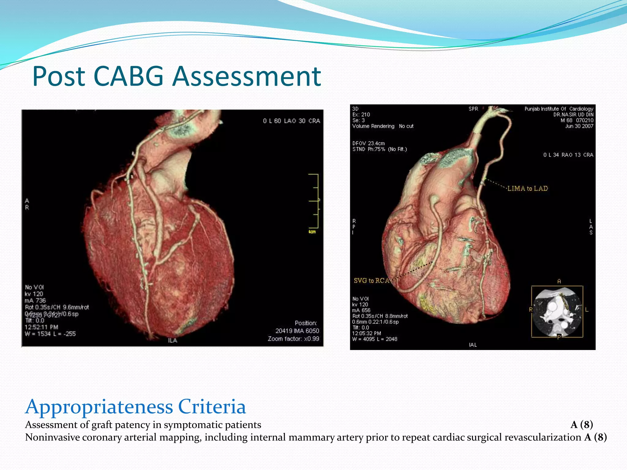 Clinical Applications Of Cardiac Ct | PPTX