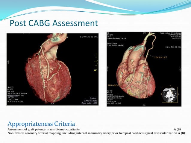 Clinical Applications Of Cardiac Ct | PPT