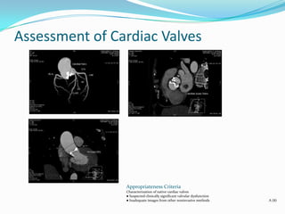 Clinical Applications Of Cardiac Ct | PPTX
