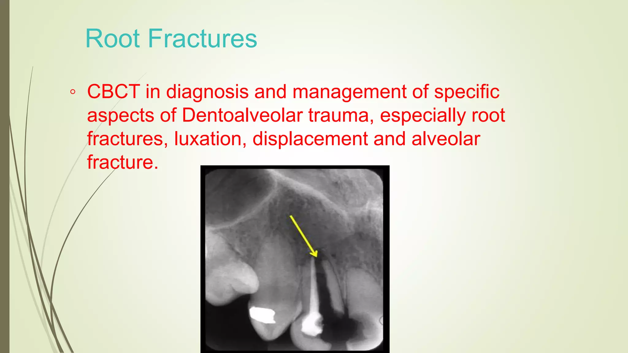 Clinical applications of CBCT | PPTX