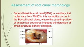 Clinical applications of CBCT | PPTX