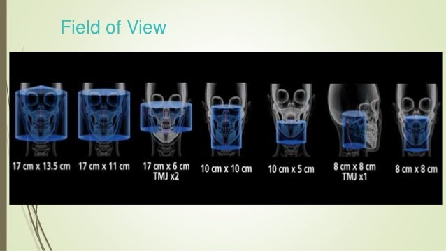 Clinical applications of CBCT