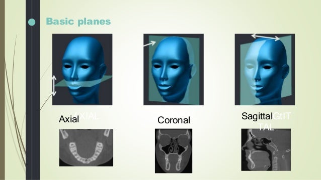 Clinical applications of CBCT
