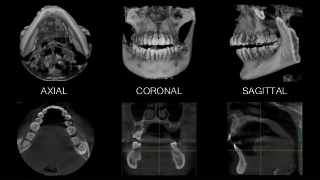 Clinical applications of CBCT