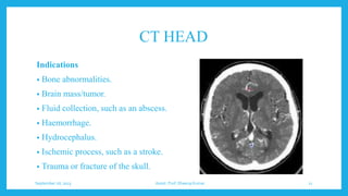 CLINICAL APPLICATIONS OF CT SCAN.pptx