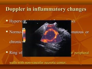 Clinical applications of doppler us. | PPT