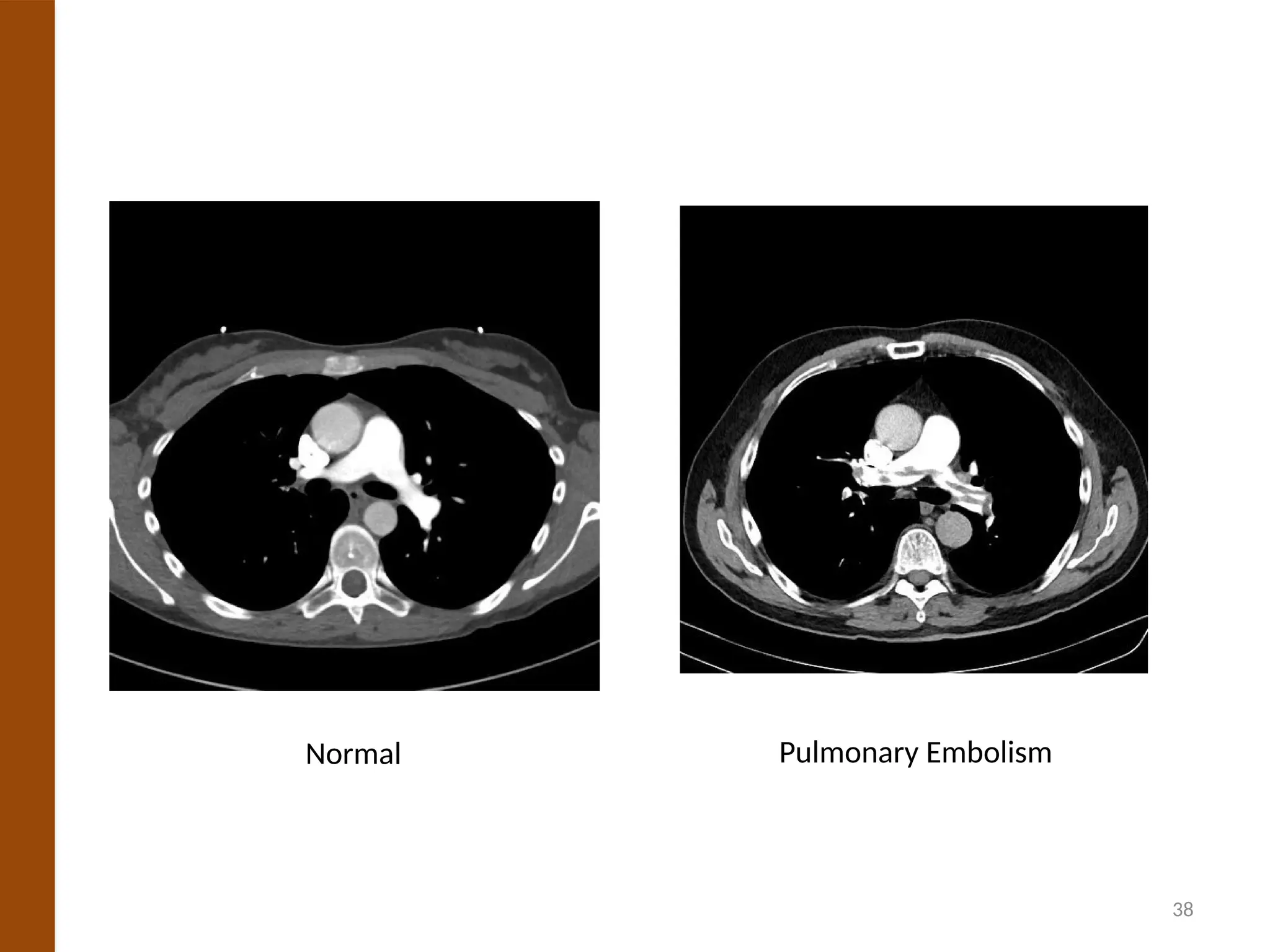 Clinical Applications of MDCT by joginder.pptx