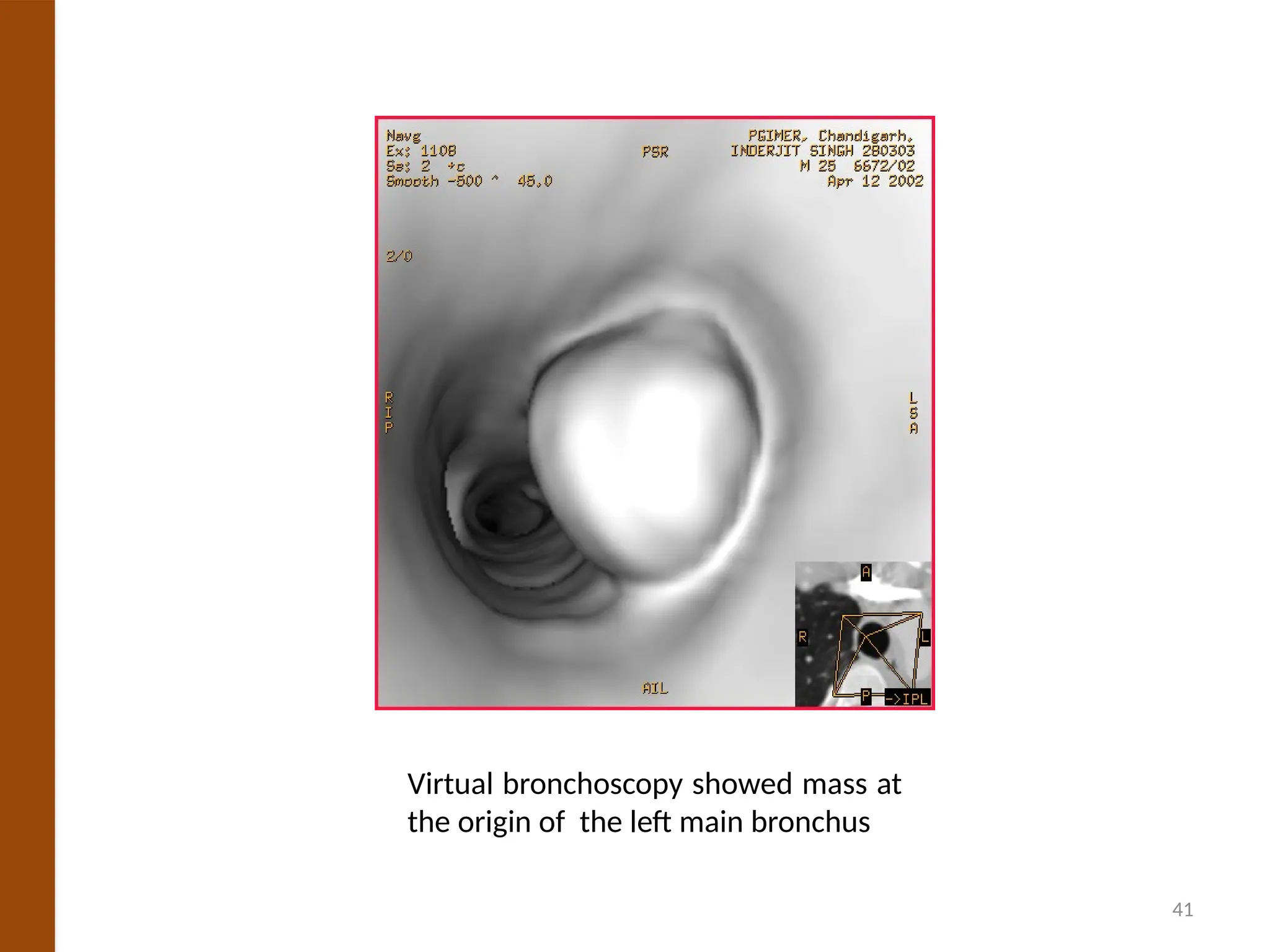 Clinical Applications of MDCT by joginder.pptx