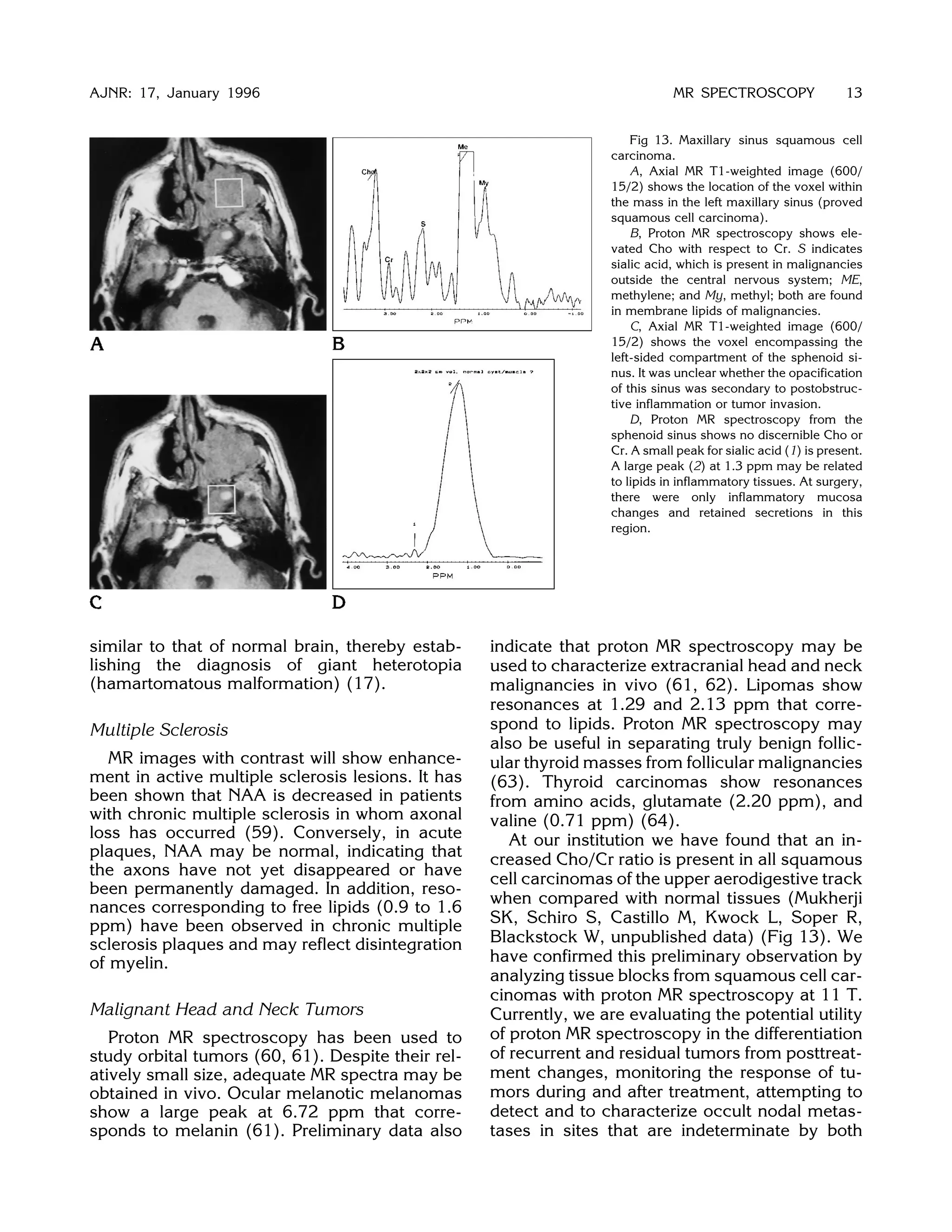 Clinical Applications of Proton MR Spectroscopy.pdf