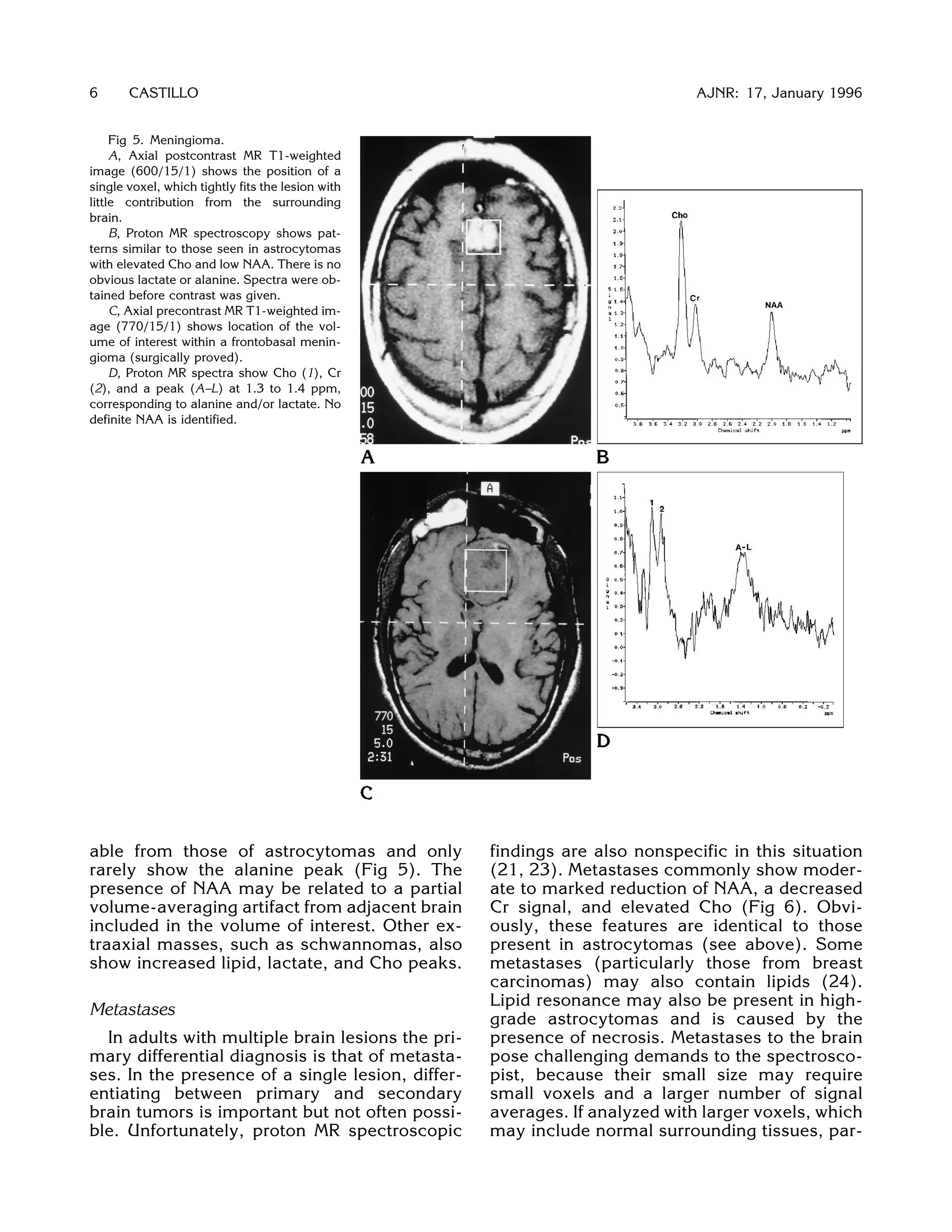 Clinical Applications of Proton MR Spectroscopy.pdf