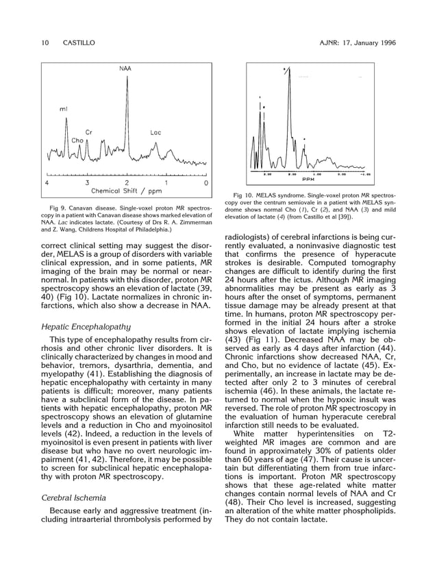 Clinical Applications of Proton MR Spectroscopy.pdf