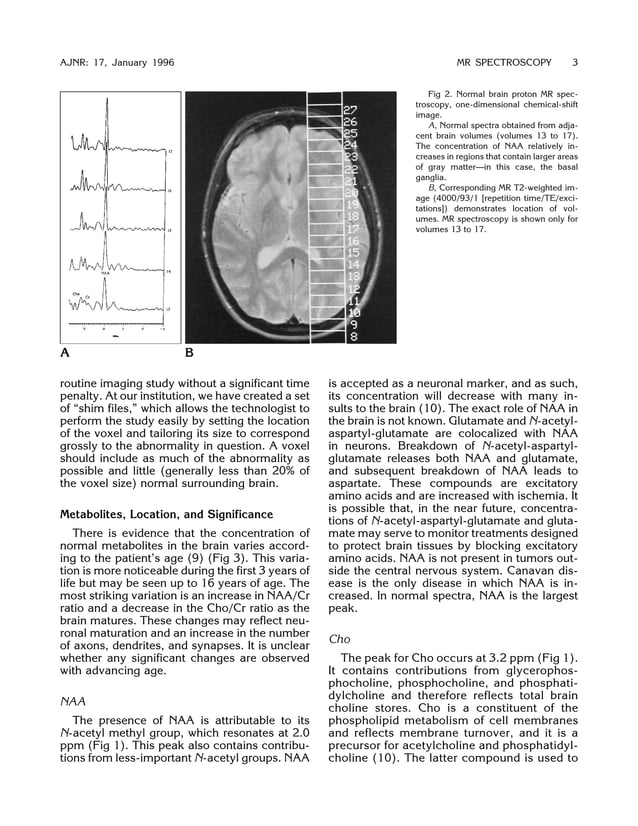 Clinical Applications of Proton MR Spectroscopy.pdf