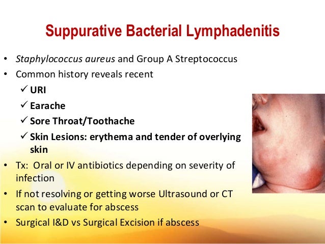 Clinical approach fever +lymphadenopathy