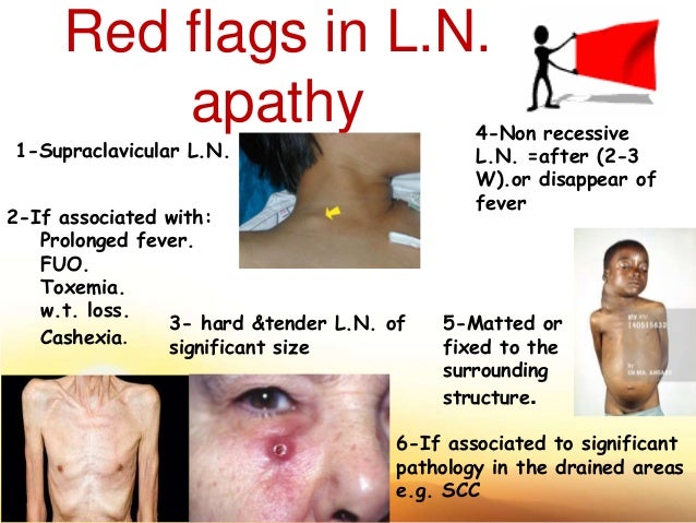 Clinical Approach Fever Lymphadenopathy