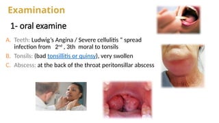 Clinical approach for Dysphagia .pptx (dysphagia) | PPTX