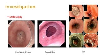 Clinical approach for Dysphagia .pptx (dysphagia) | PPTX