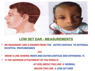 clinical approach to CHD.pdf