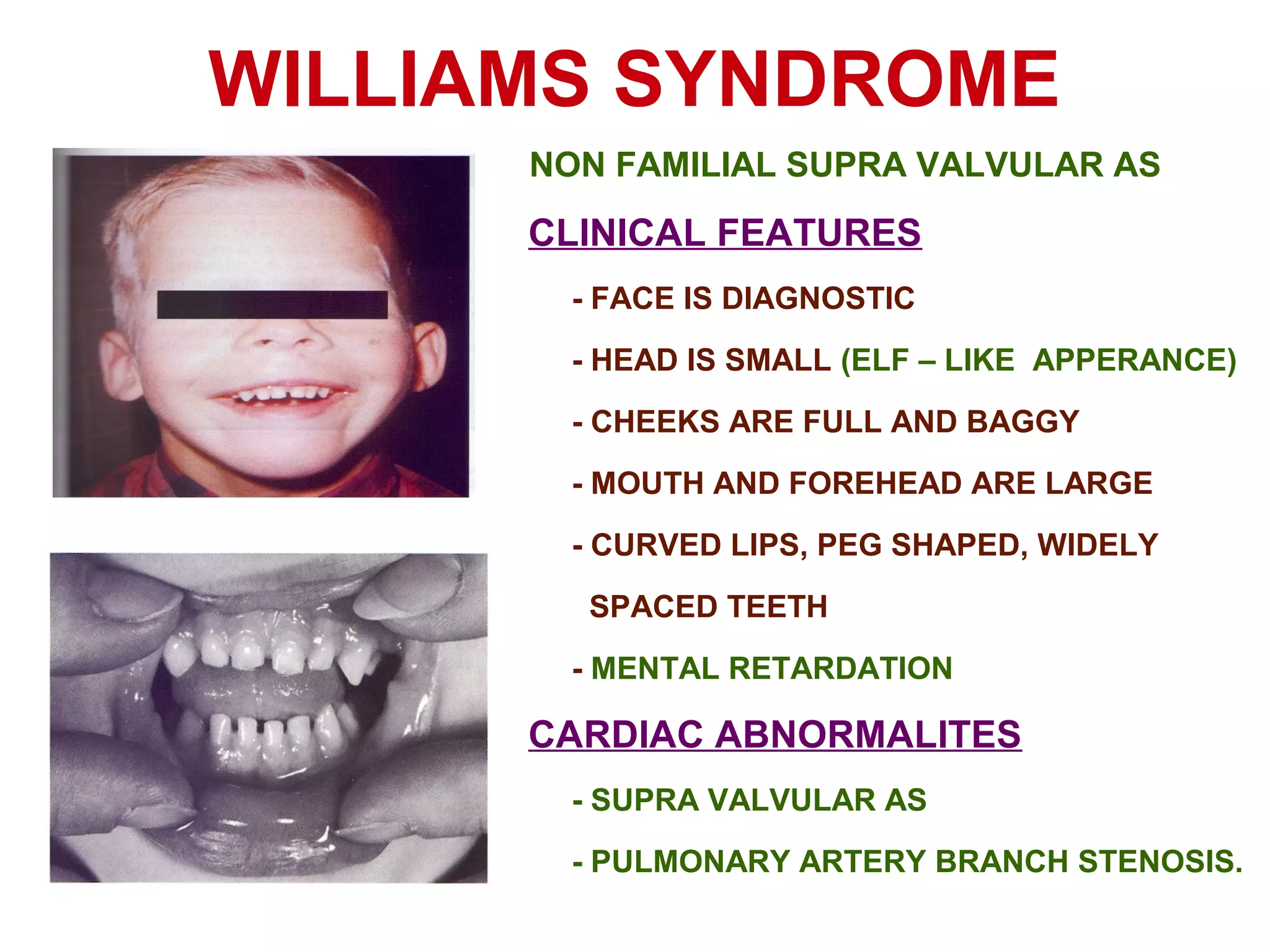 Clinical approach to congenital heart disease diagnosis | PPT