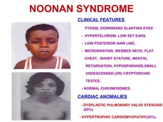 Clinical approach to congenital heart disease diagnosis | PPT