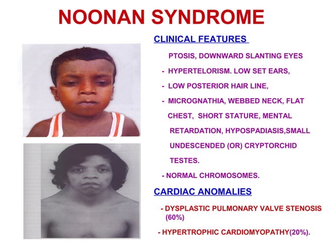 Clinical approach to congenital heart disease diagnosis | PPT ...
