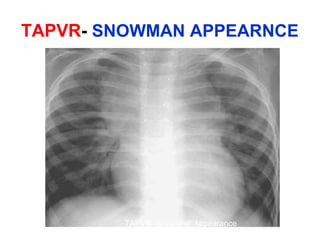 Clinical approach to congenital heart disease diagnosis | PPT