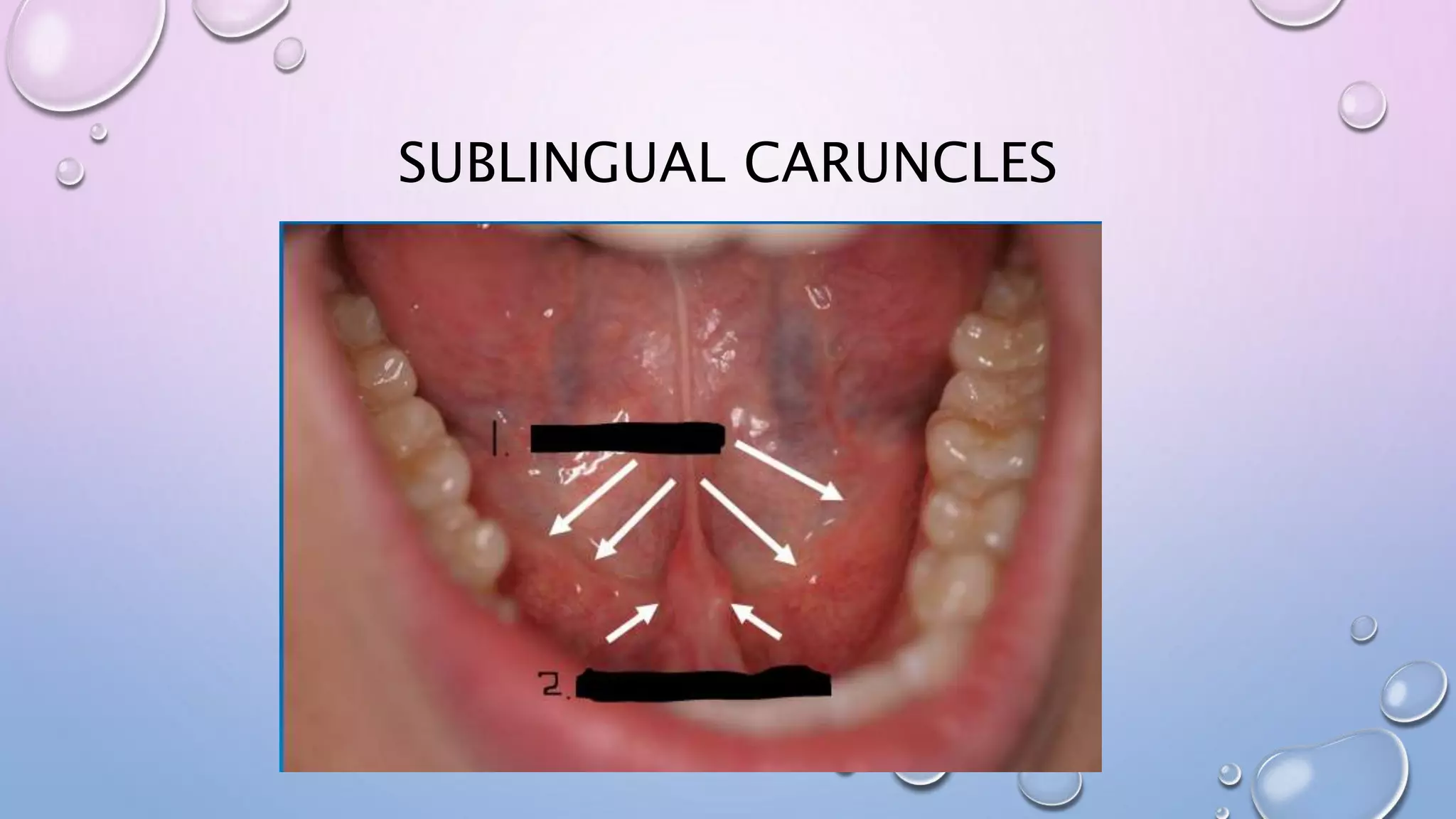 Clinical approach to oral neoplasms