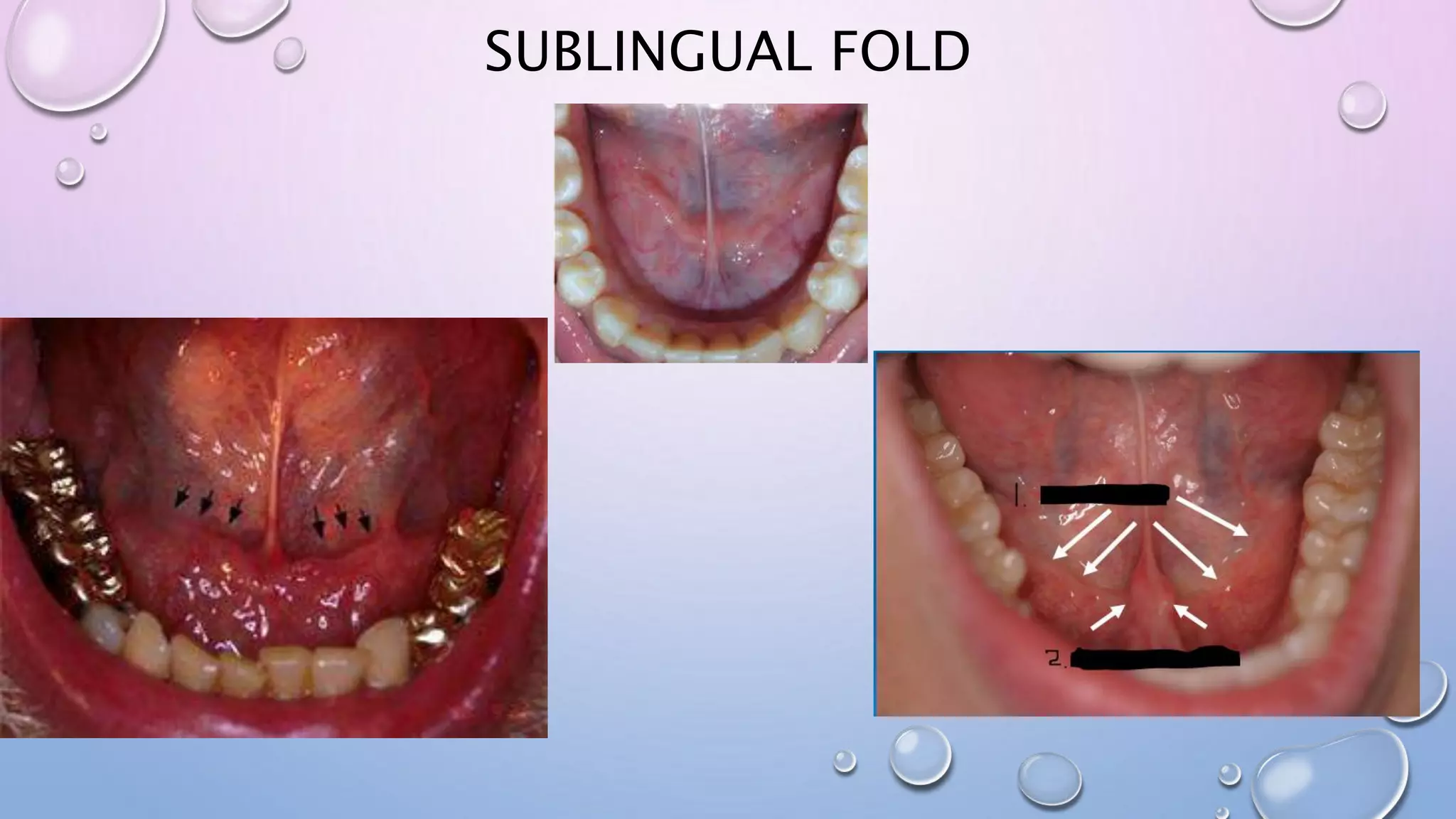 Clinical approach to oral neoplasms
