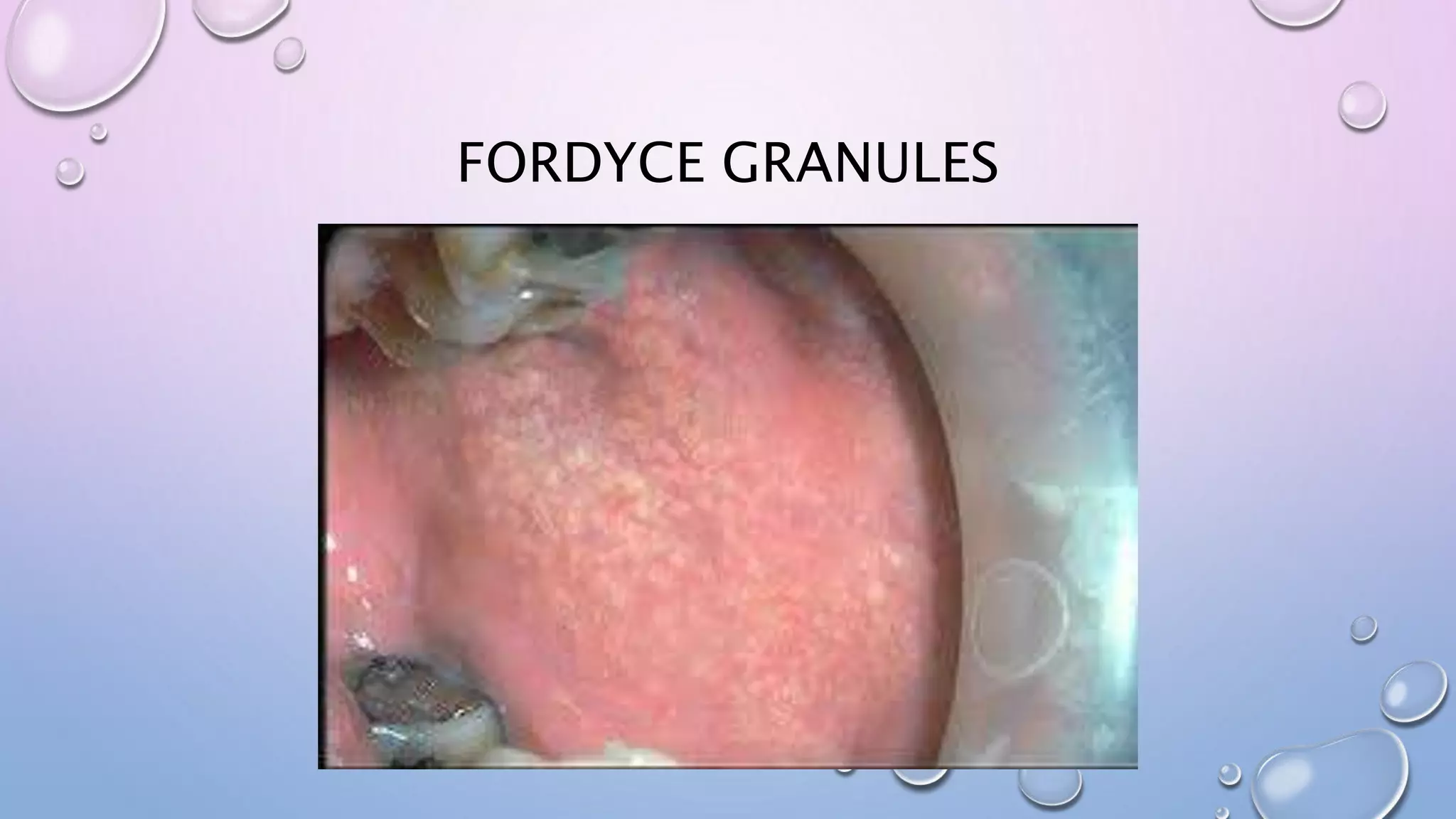 Clinical approach to oral neoplasms