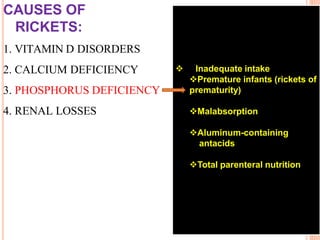Clinical approach to rickets with special reference to renal rickets ...