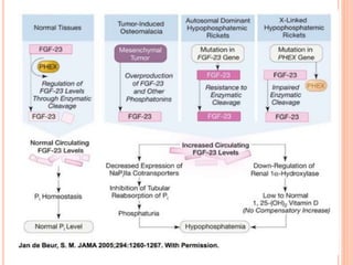 Clinical approach to rickets with special reference to renal rickets ...