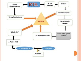Clinical approach to rickets with special reference to renal rickets ...