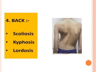 Clinical approach to rickets with special reference to renal rickets ...