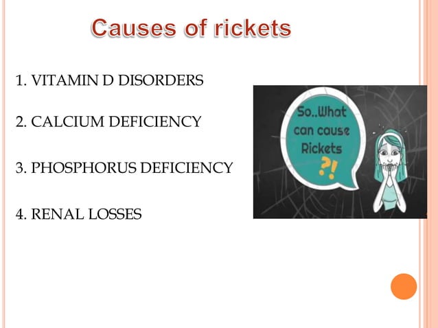 Clinical approach to rickets with special reference to renal rickets ...