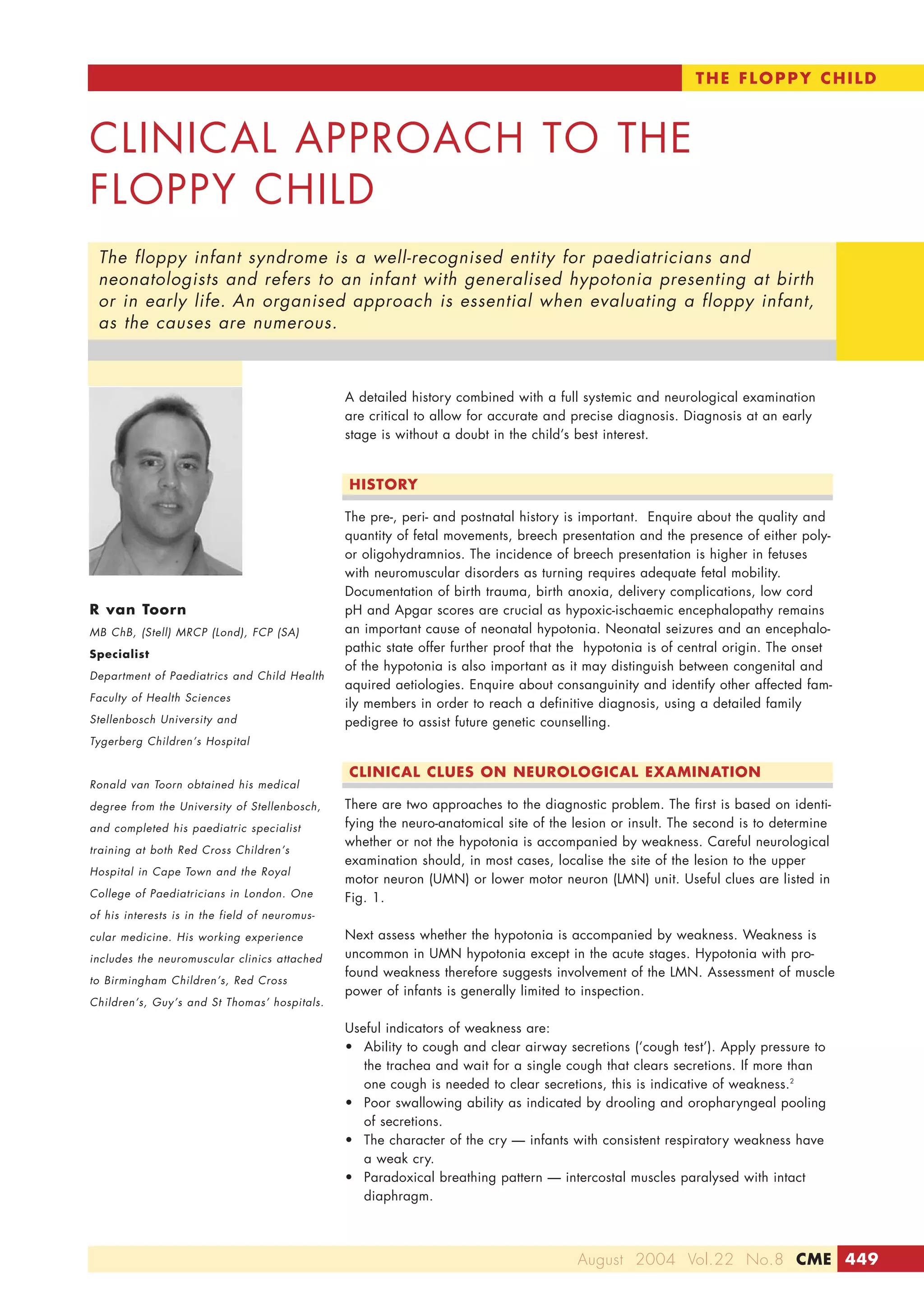 Clinical approach to the floppy child | PDF