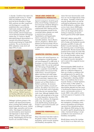 Clinical approach to the floppy child | PDF