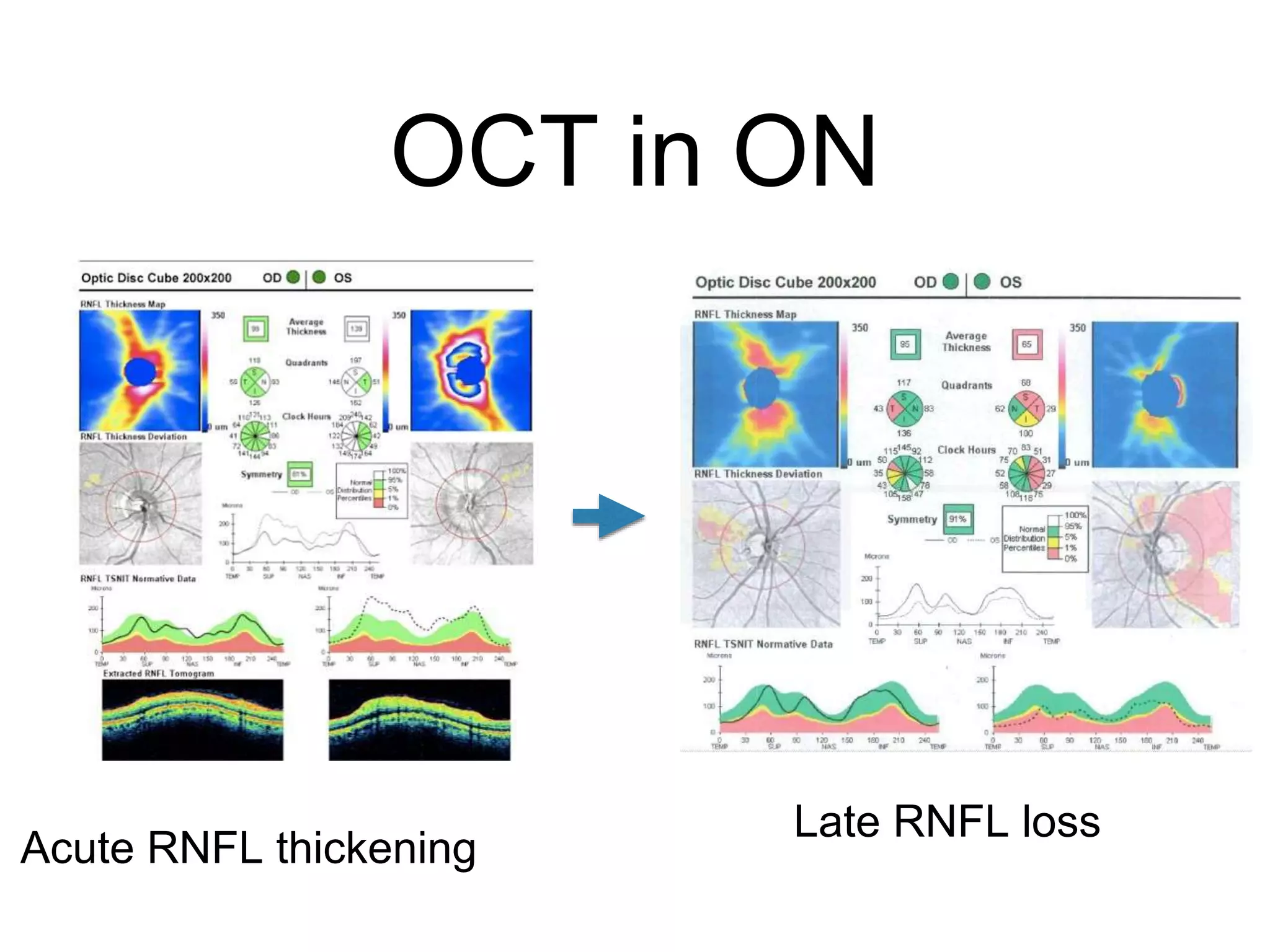 Clinical approach to acute vision loss | PPTX