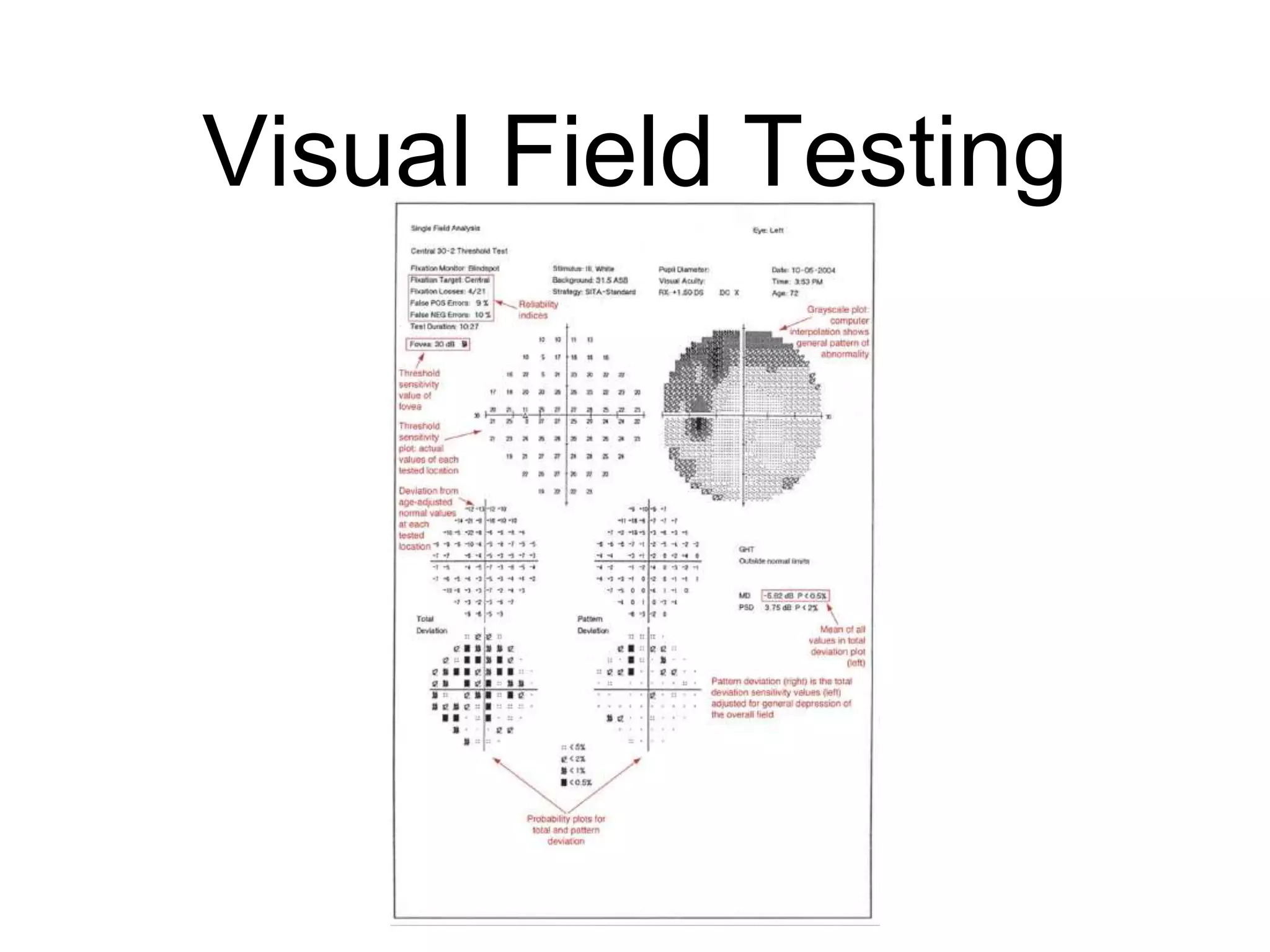 Clinical approach to acute vision loss | PPTX